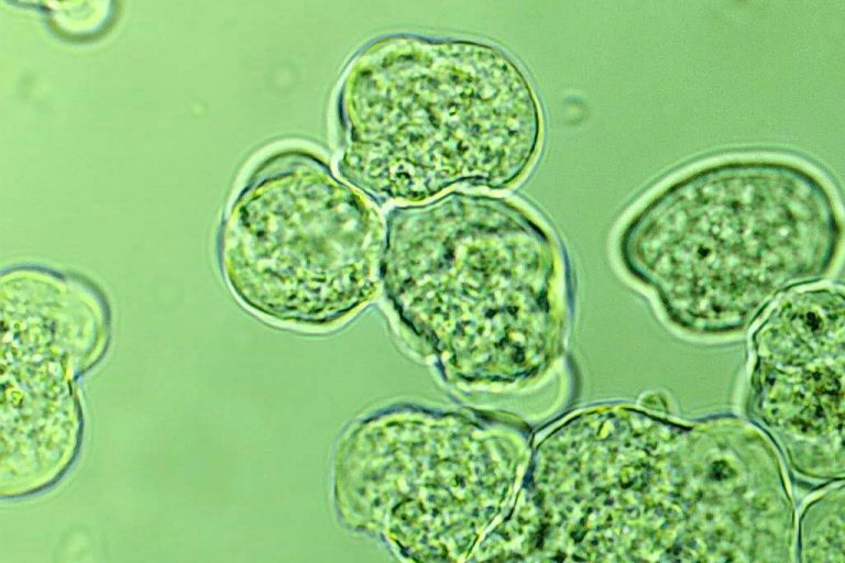 Paraziti u crijevima - kako ih prepoznati i očistiti